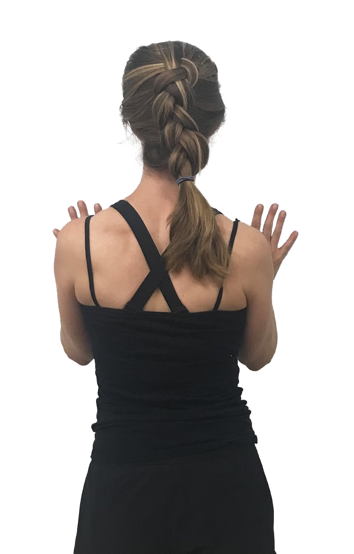 Anterior shoulder dislocation without bony injury - Leeds Teaching ...