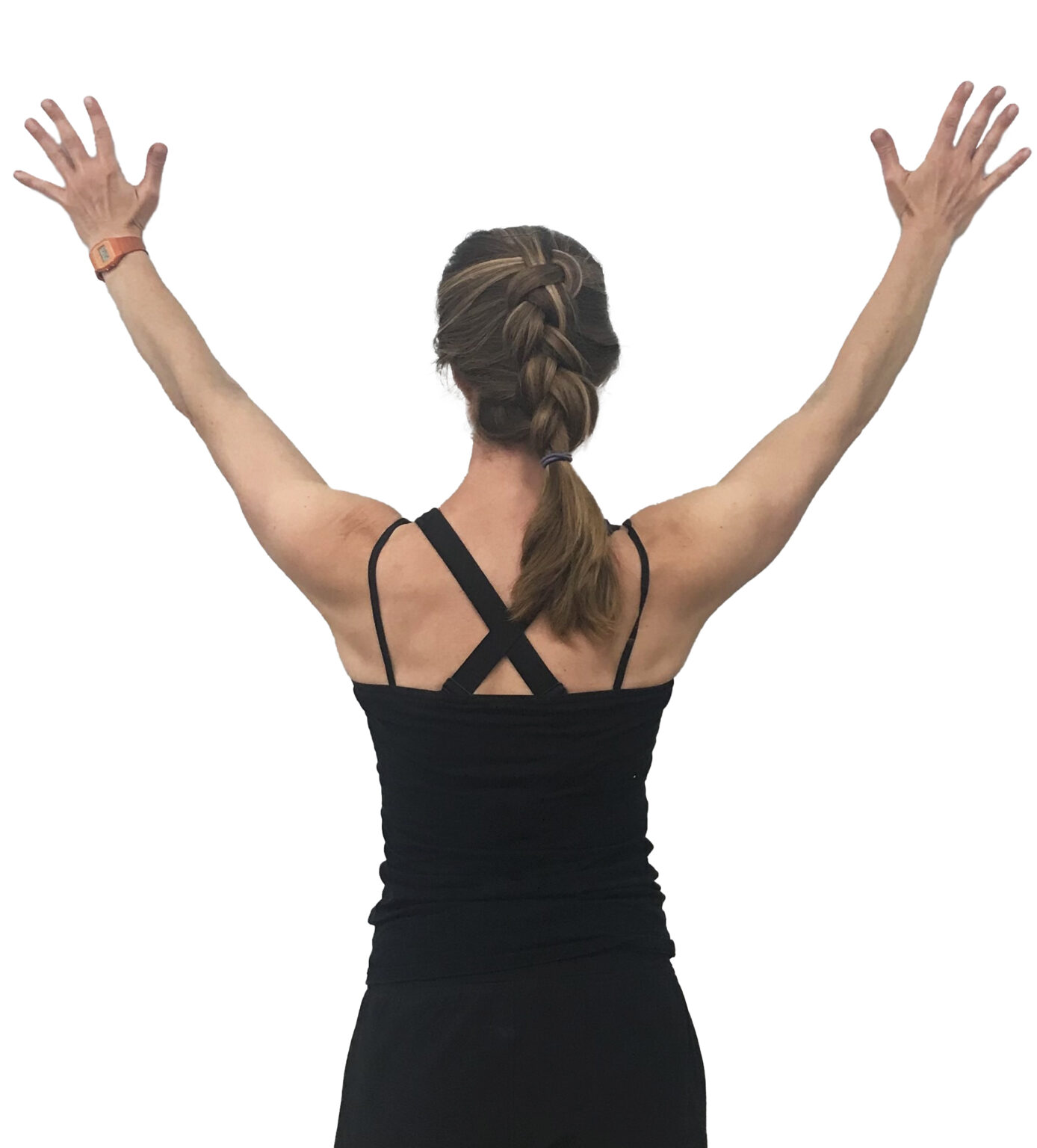 Anterior shoulder dislocation without bony injury - Leeds Teaching ...