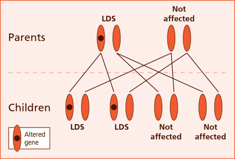 Loeys-Dietz Syndrome - Leeds Teaching Hospitals NHS Trust