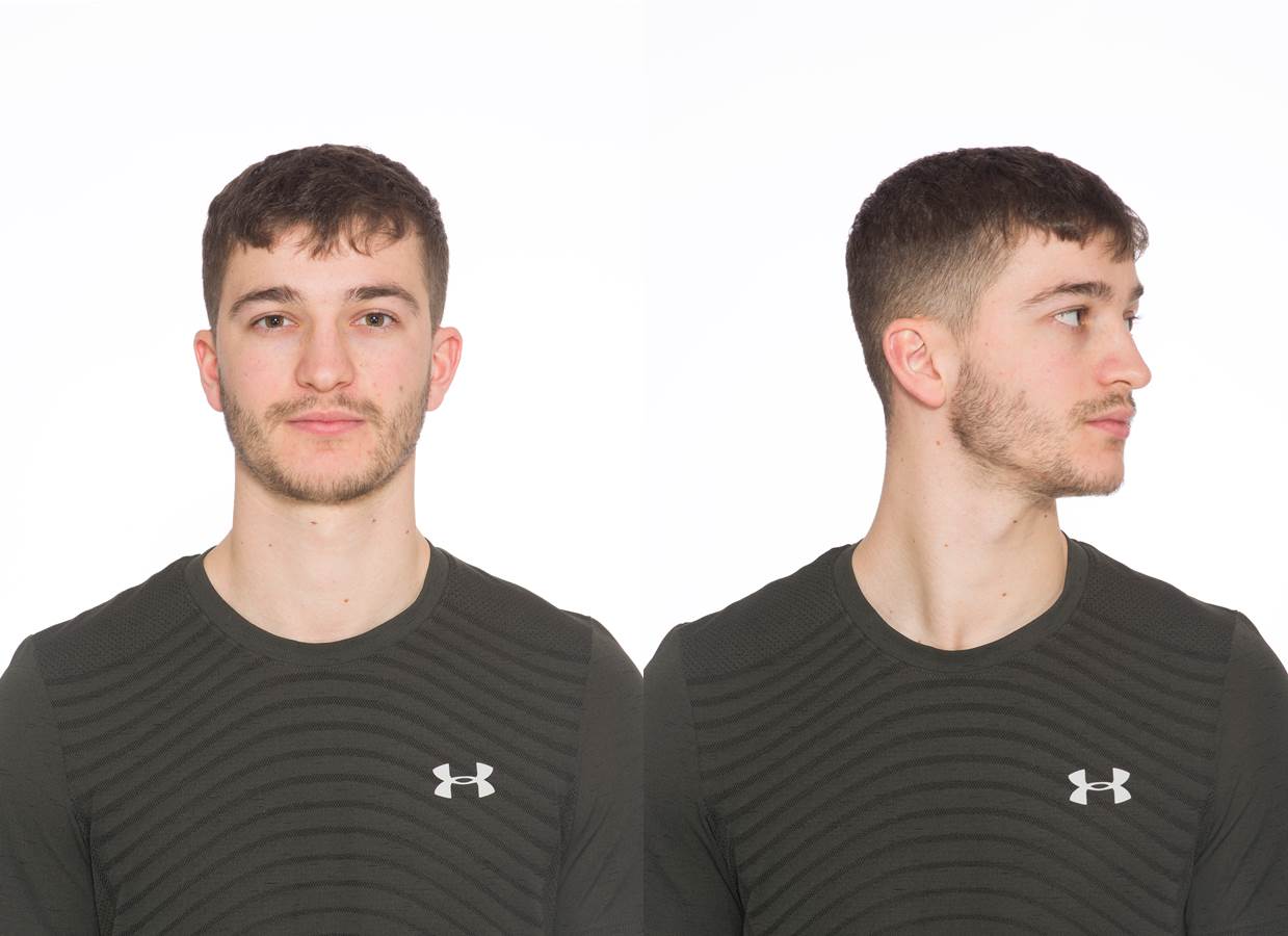 A post-operative Guide to Thoracic Spinal Surgery - Leeds Teaching ...