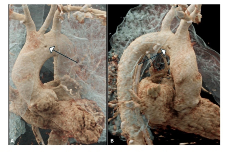 Pick of the publications – from LTHT Library and Knowledge Service ...