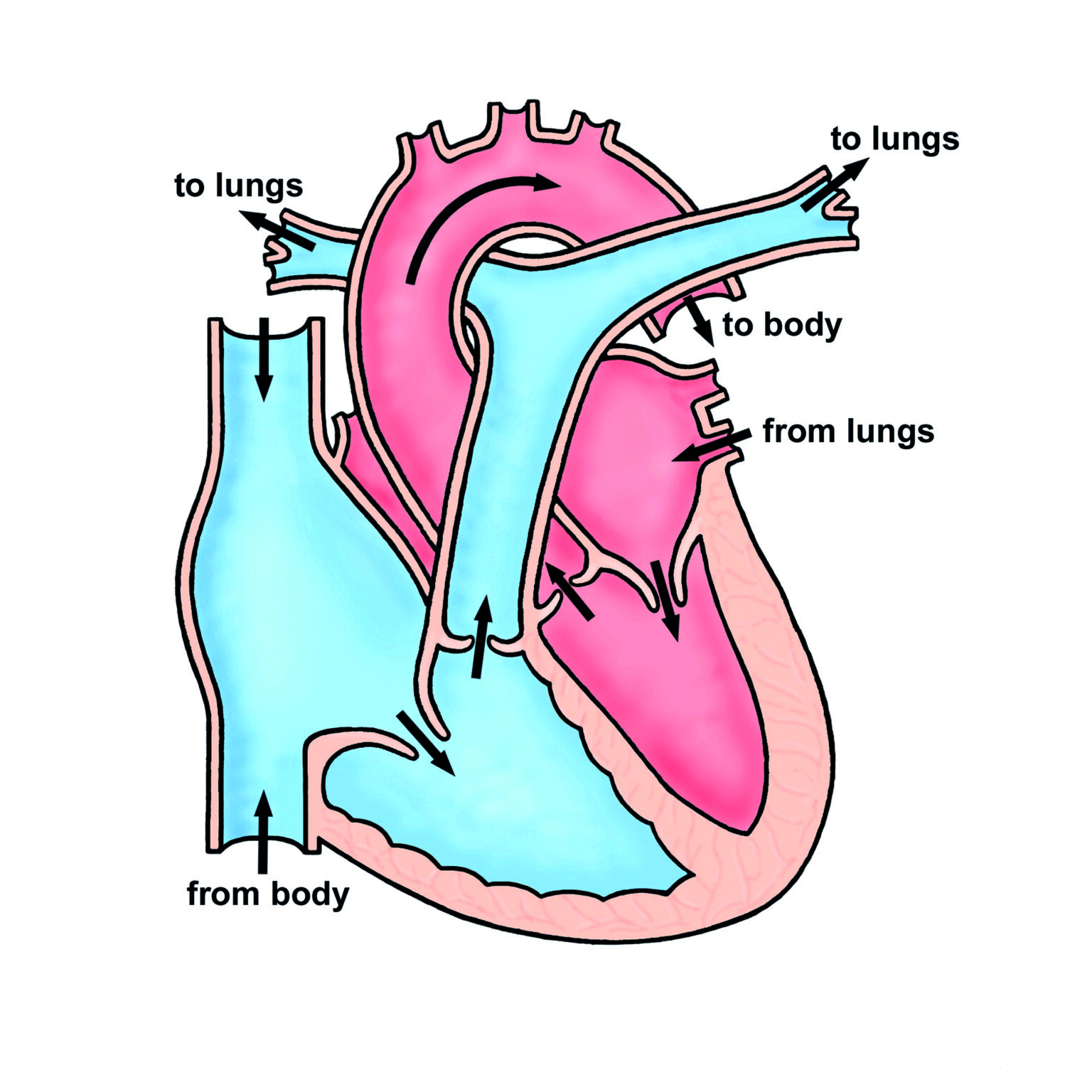 Pulmonary Stenosis - Leeds Teaching Hospitals NHS Trust