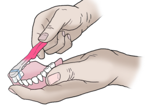Complete Dentures - Leeds Teaching Hospitals NHS Trust