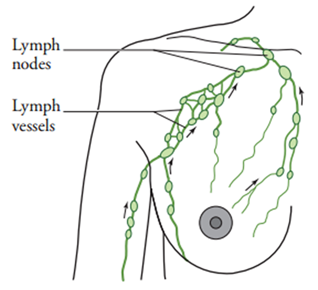 Breast cancer your treatment and recovery in Leeds - Leeds Teaching ...