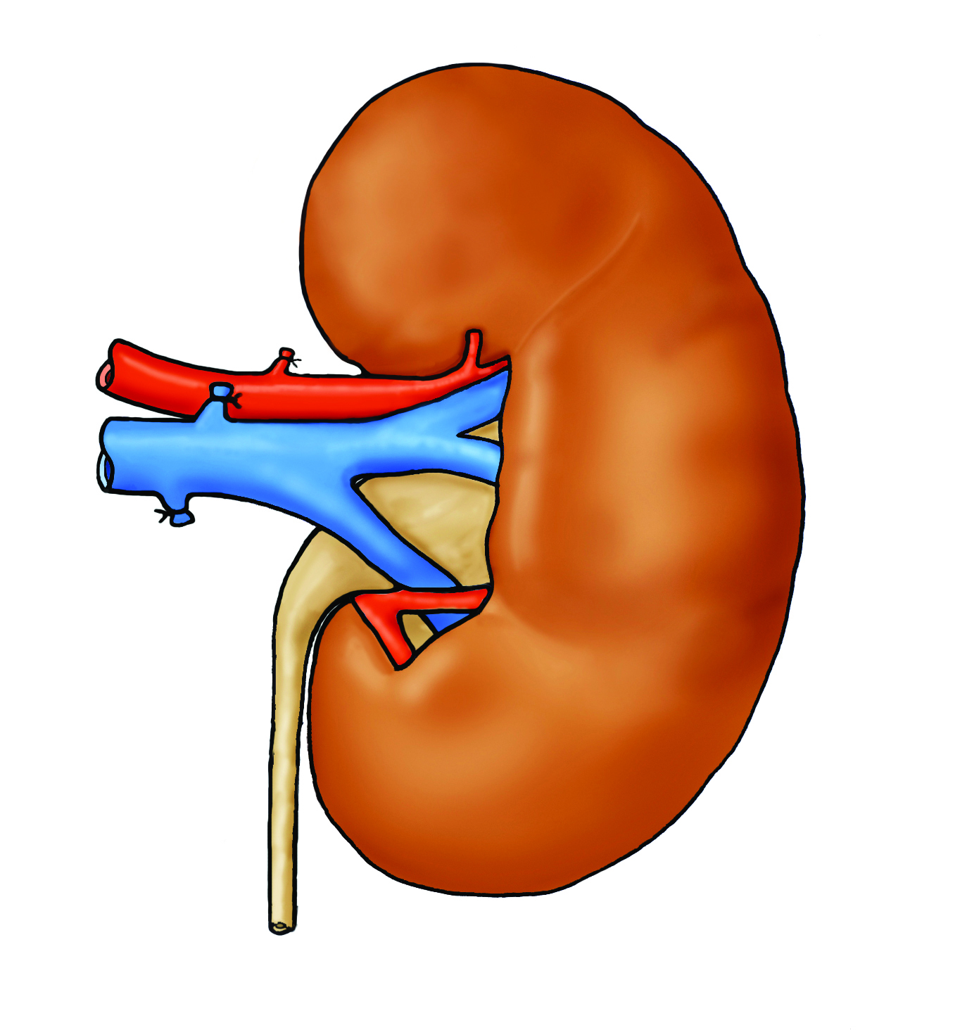 Is Kidney Transplantation for you? - Leeds Teaching Hospitals NHS Trust