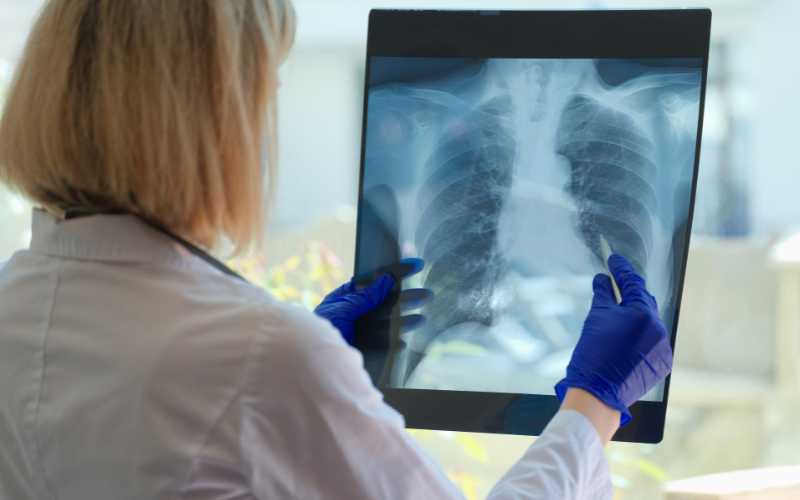 World Tuberculosis Day 2025: A global health reminder - Leeds Teaching ...