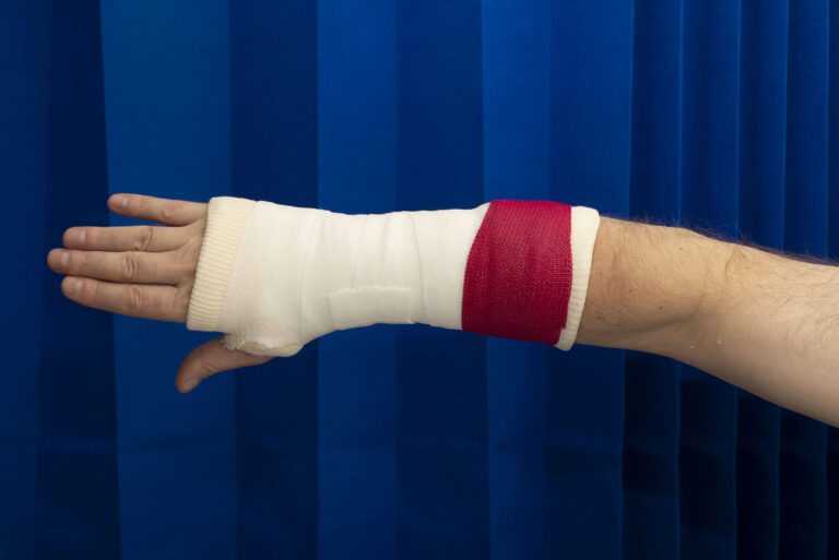 Your Cast and Brace Passport - Leeds Teaching Hospitals NHS Trust