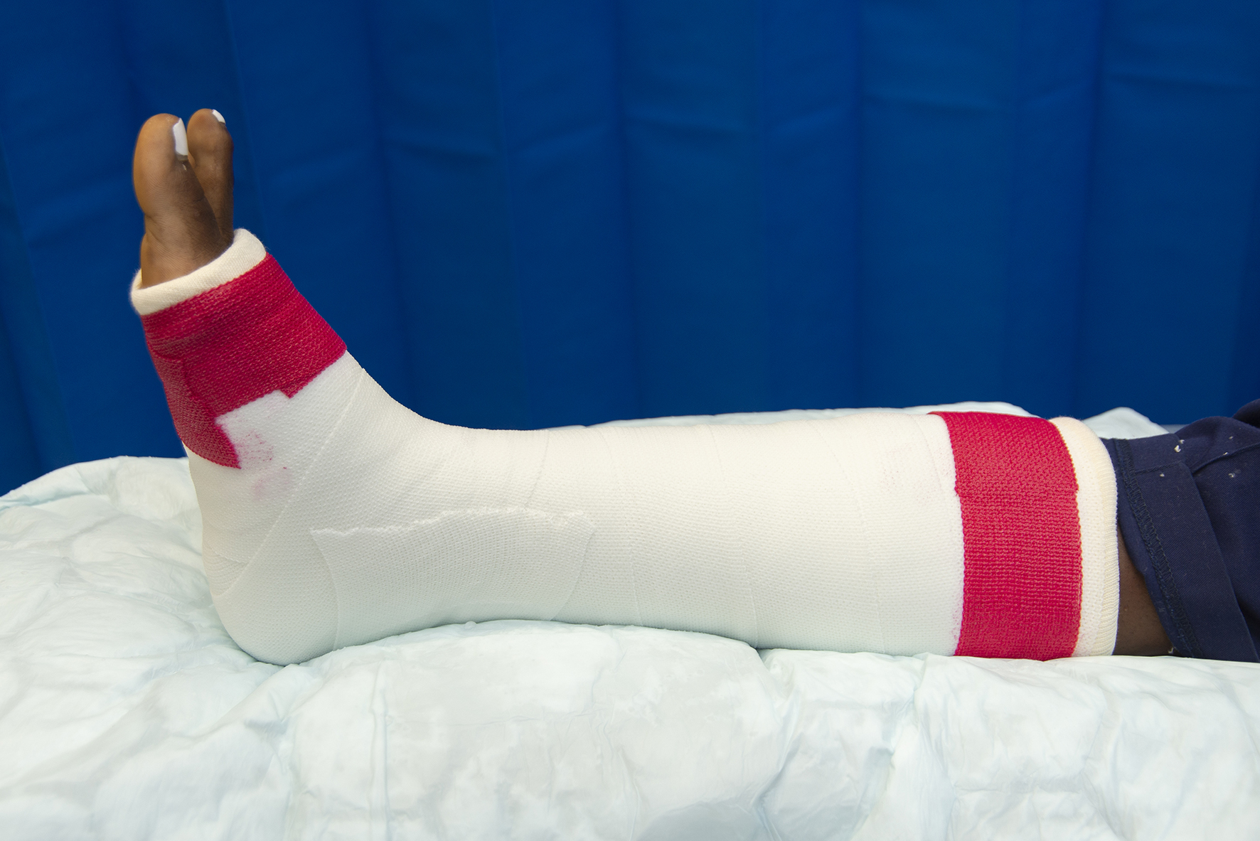 Your Cast and Brace Passport - Leeds Teaching Hospitals NHS Trust