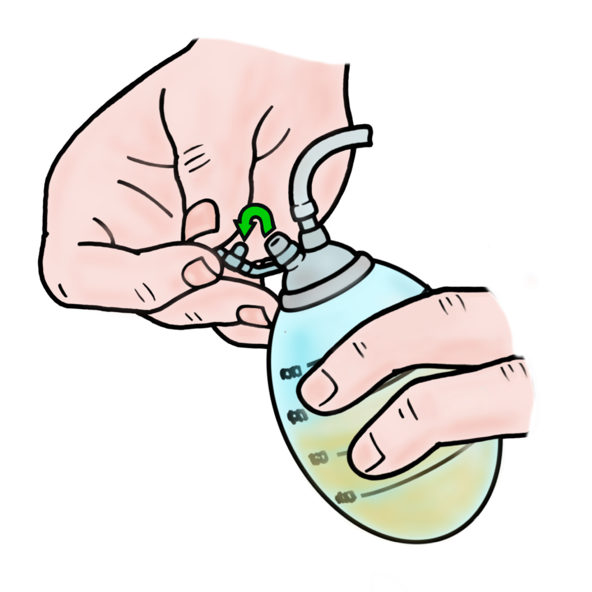 How to record your drain output following Inguinal Lymph Node ...