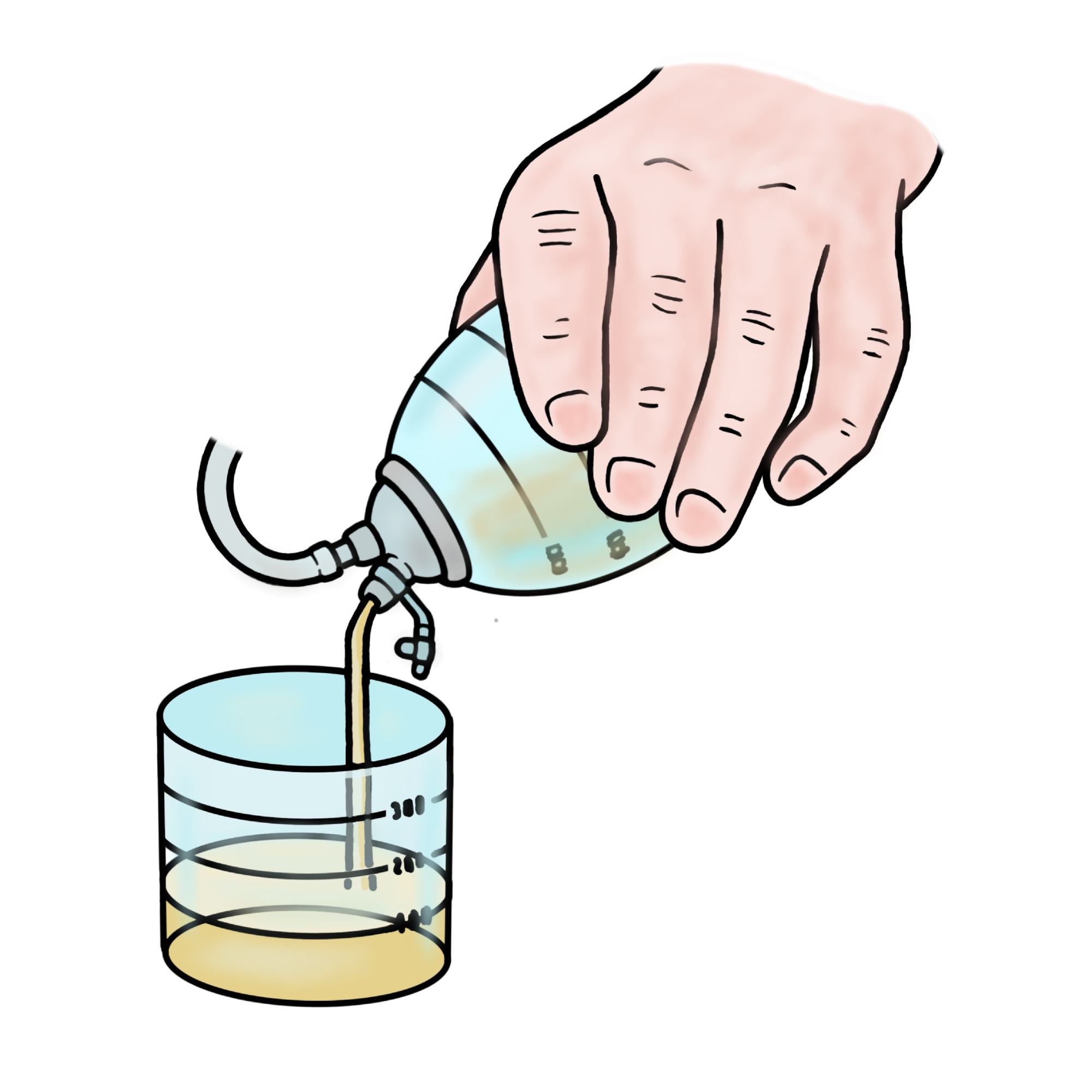 How to record your drain output following Inguinal Lymph Node Dissection - Leeds Teaching ...