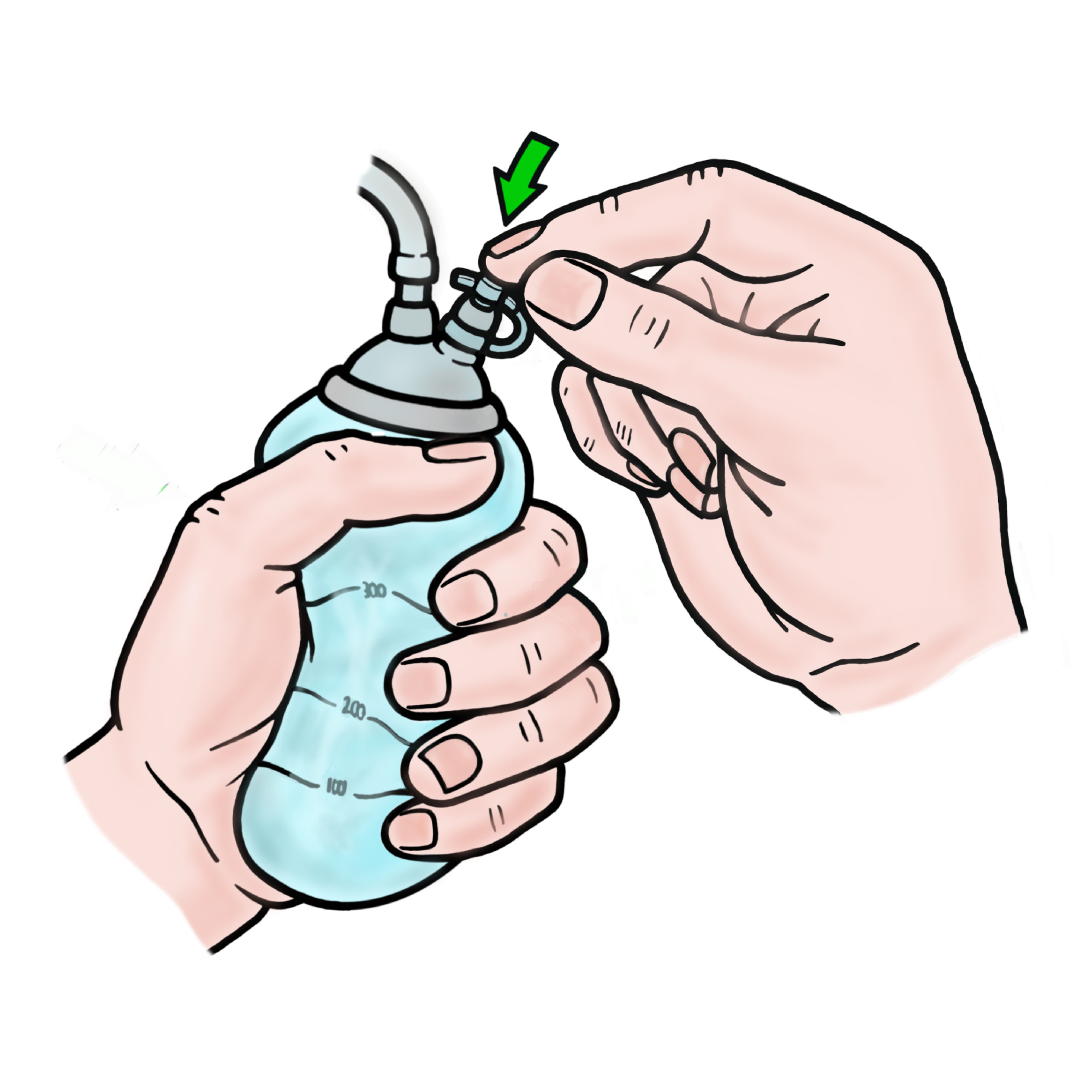 How to record your drain output following Inguinal Lymph Node ...