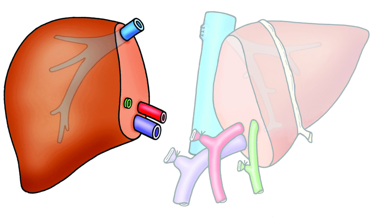 Information for potential Living Liver Donors - Leeds Teaching ...