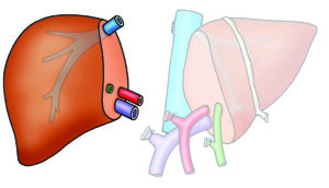 Information for potential Living Liver Donors - Leeds Teaching ...