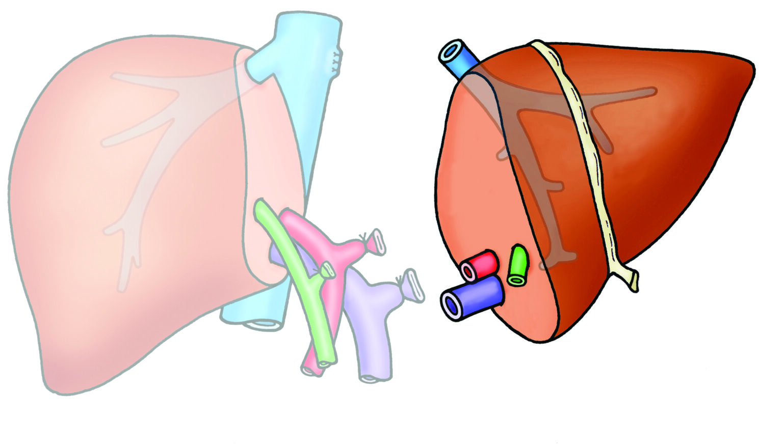 Information for potential Living Liver Donors - Leeds Teaching ...