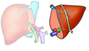 Information for potential Living Liver Donors - Leeds Teaching ...