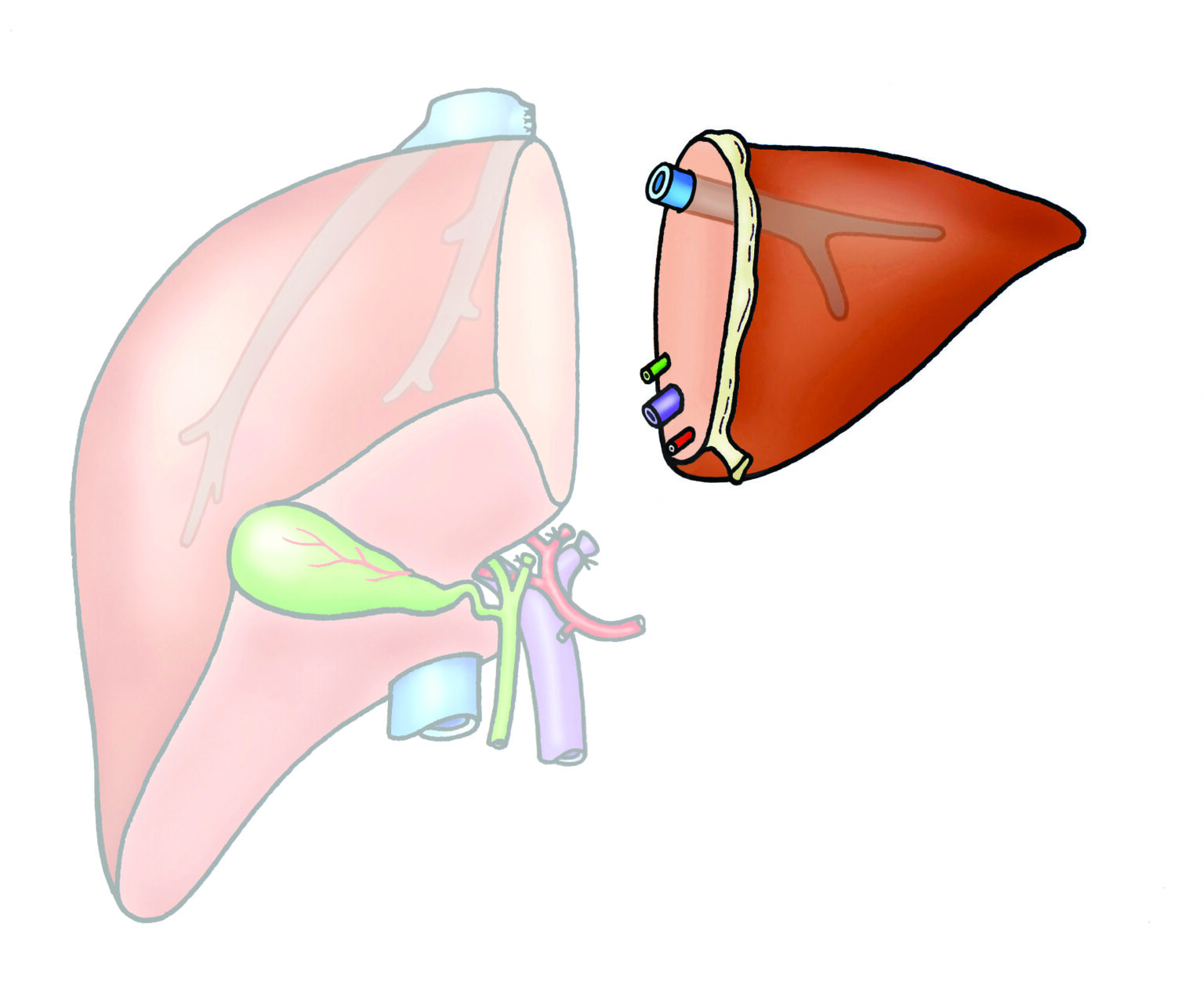 Information for potential Living Liver Donors - Leeds Teaching ...