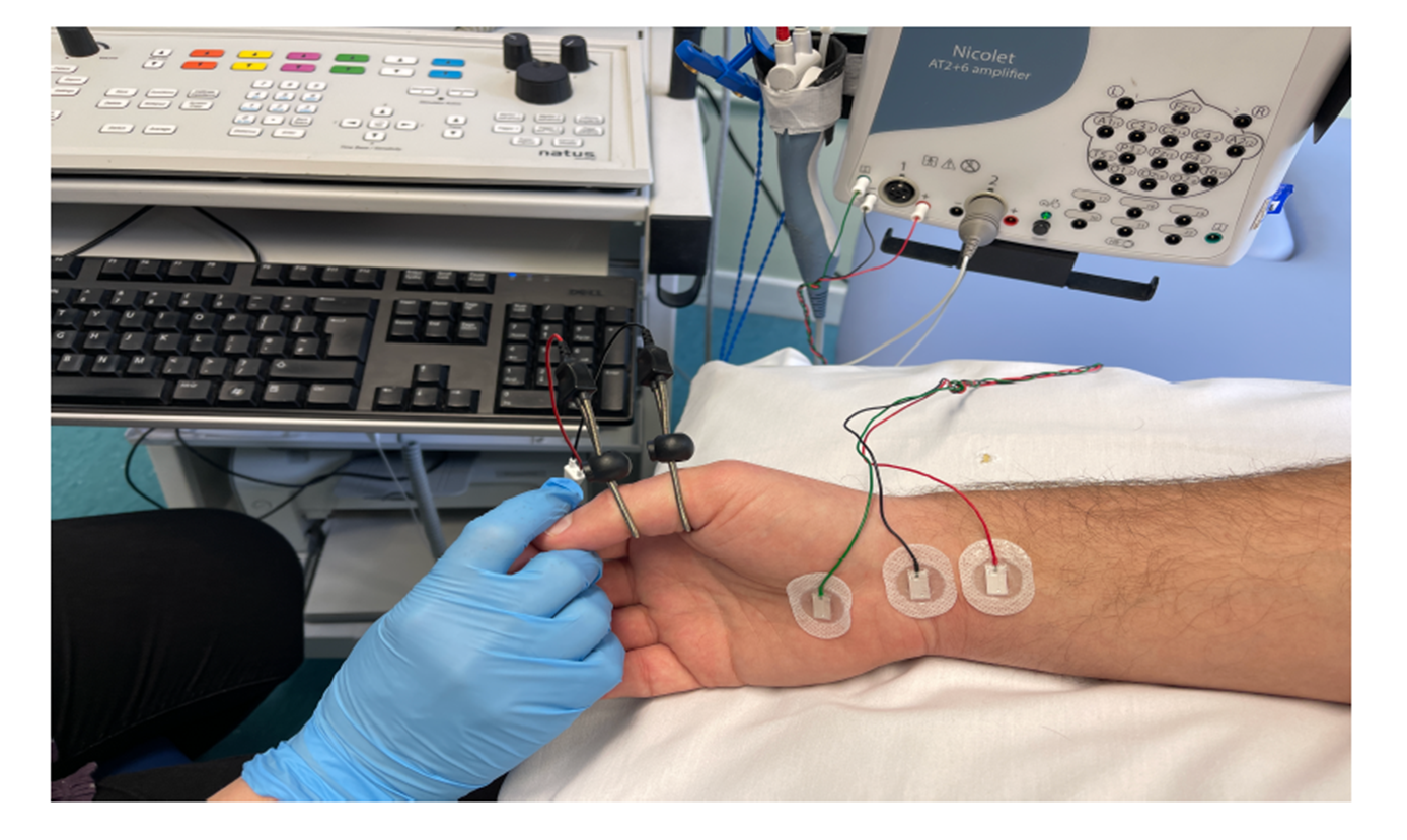 Electromyography (EMG) Test / Nerve conduction studies (NCS) - Leeds ...