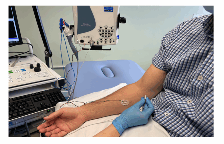 Electromyography (EMG) Test / Nerve conduction studies (NCS) - Leeds ...