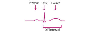 Long QT Syndrome - Leeds Teaching Hospitals NHS Trust