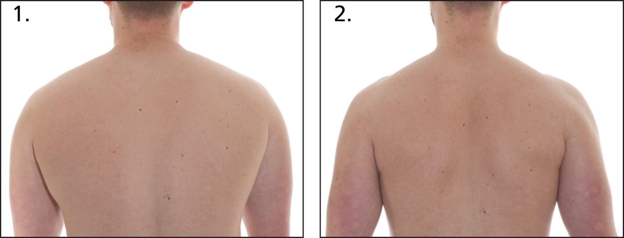 Shoulder exercises - Leeds Teaching Hospitals NHS Trust