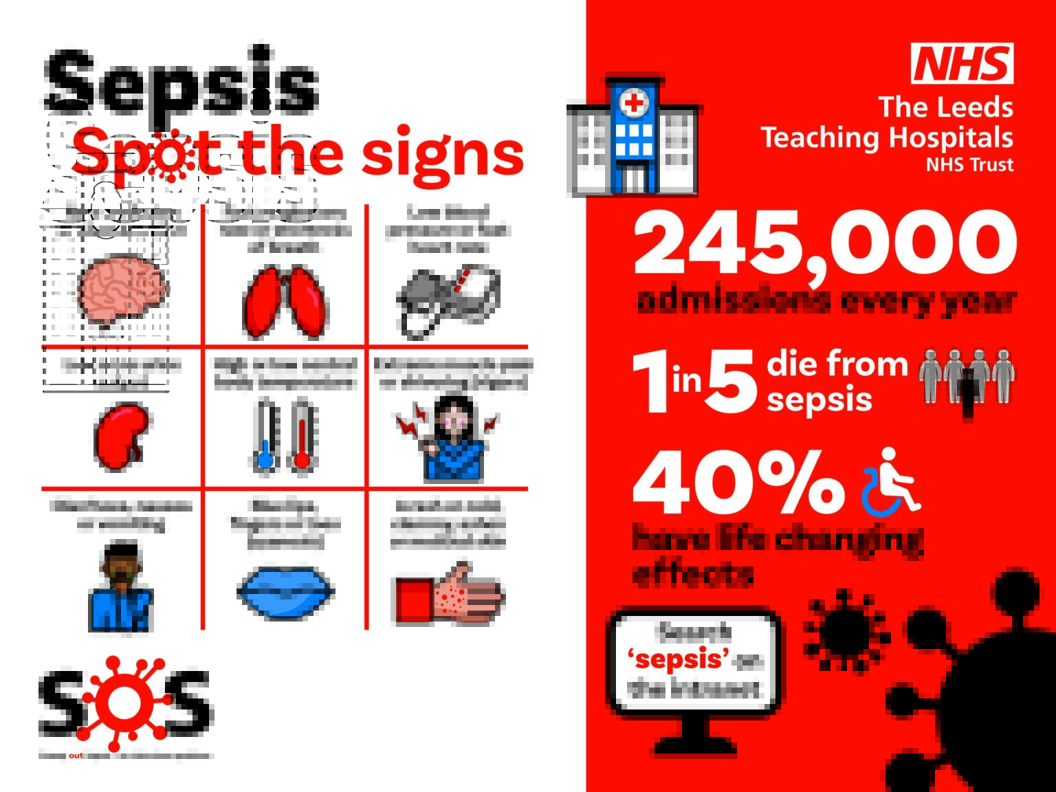 New roles and training strengthen awareness of sepsis in hospital ...